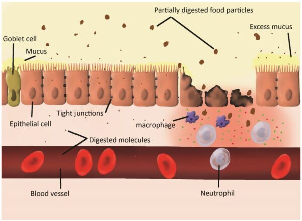 How can you tell if your small intestine is healthy or damaged? - Dr ...